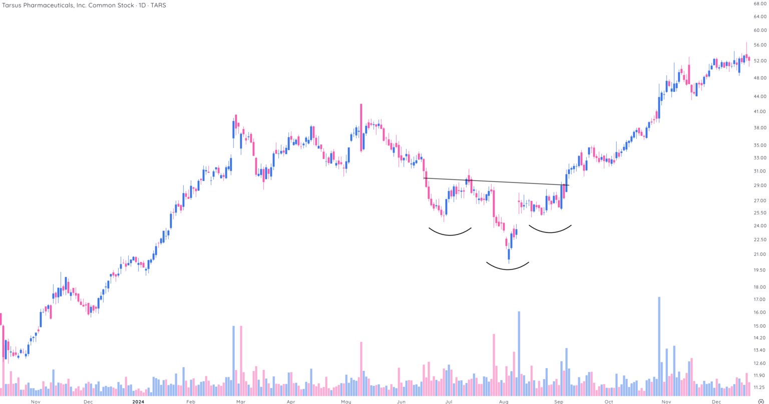 9 Best Swing Trading Patterns Every Trader Should Know | TraderLion