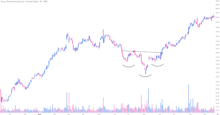 9 Best Swing Trading Patterns Every Trader Should Know | TraderLion